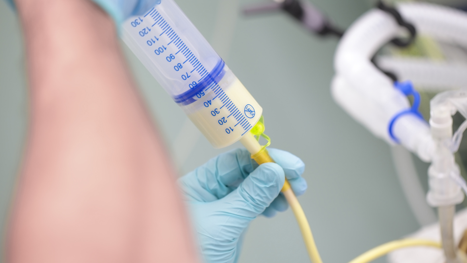 Nasogastric (NG) Tube Placement - GI for Kids